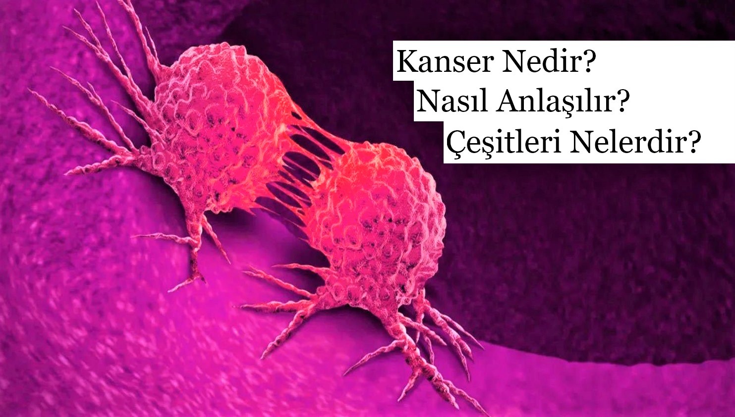 Kanser Nedir? Nasıl Anlaşılır? Çeşitleri Nelerdir? - Güzel Bilgiler